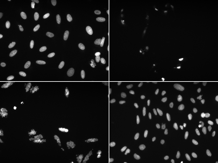 Day 2, exercise 3: Advanced segmentation and organelle analysis — BAB3 (Bioimage Analysis ...